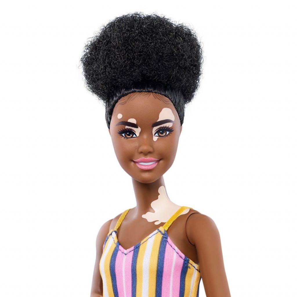 Vitiligo, handicap : Barbie célèbre la diversité avec sa nouvelle ...
