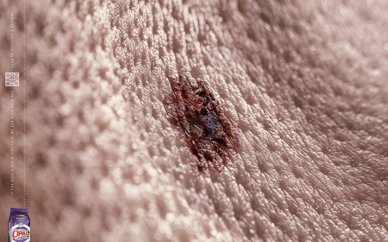 Cette lessive détourne les taches pour sensibiliser au cancer de la peau